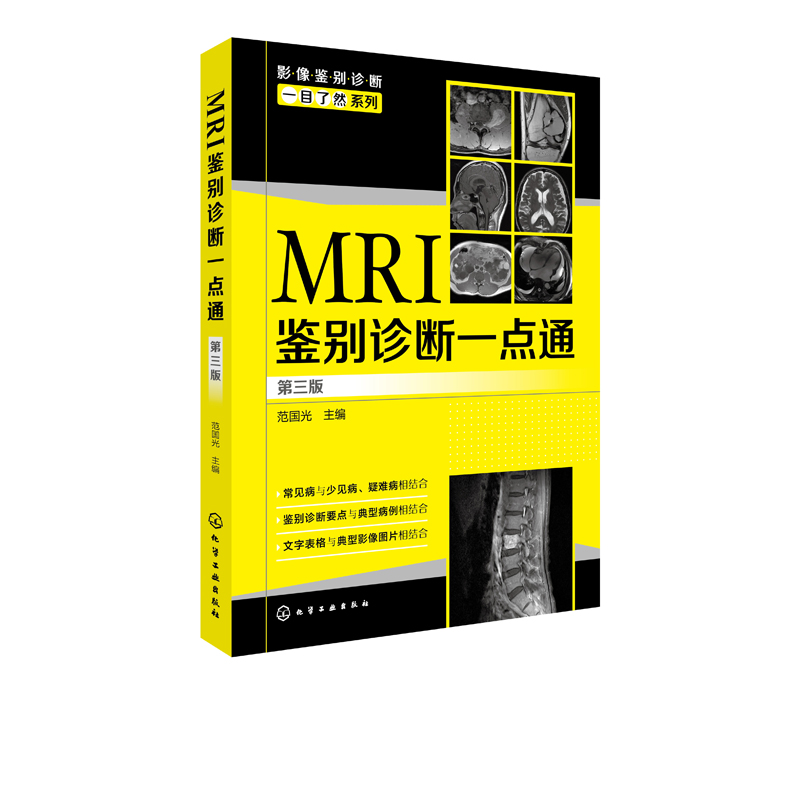 现货 MRI鉴别诊断一点通 第三版 医学影像学 临床科室医生影像科医师参考图书籍 影像医生和相关专业