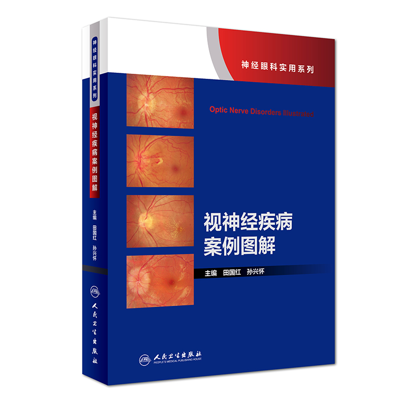 神经眼科实用系列：视神经疾病案例图解