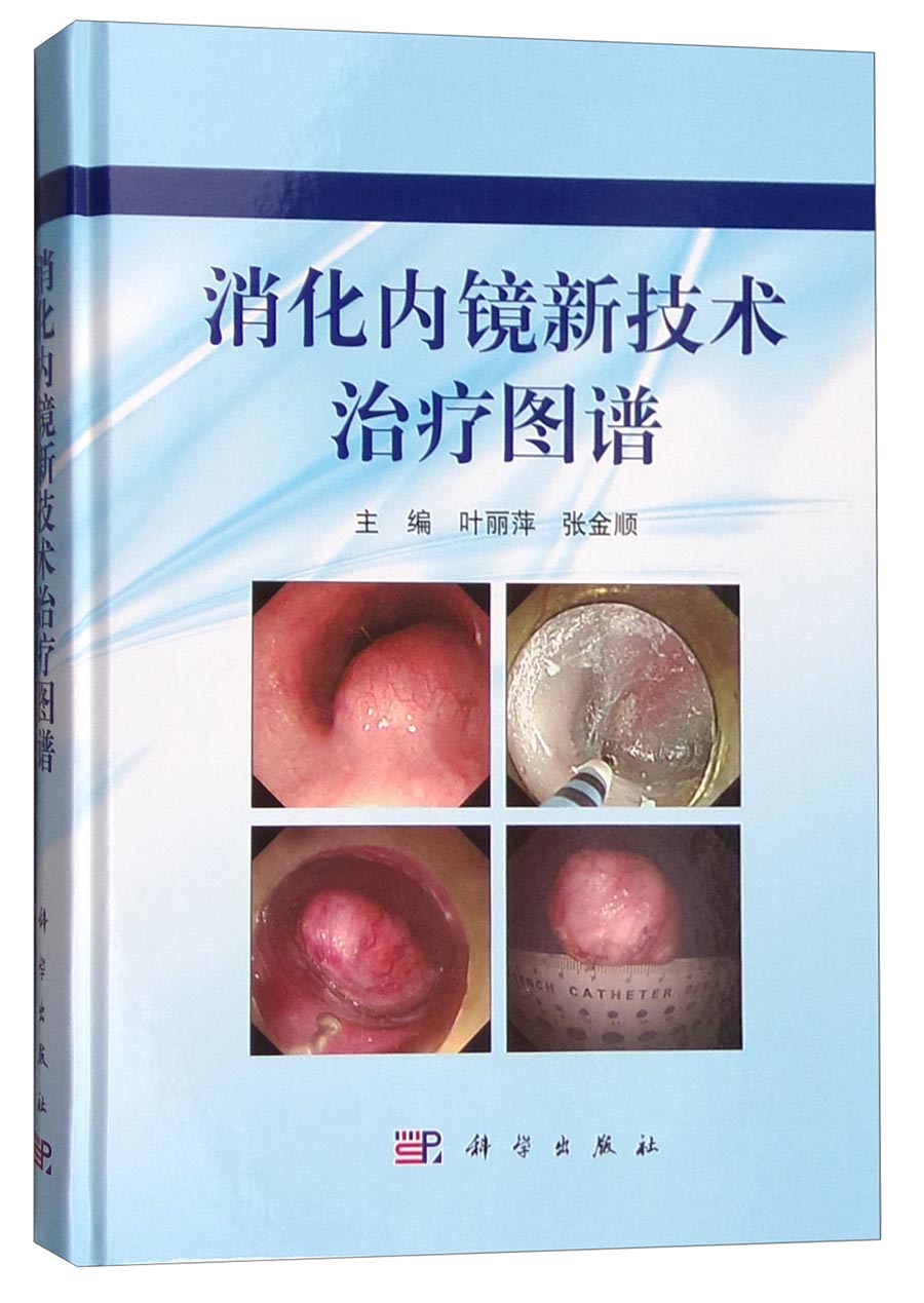 消化内镜新技术治疗图谱