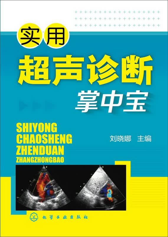 实用超声诊断掌中宝（全彩图解、铜版纸）
