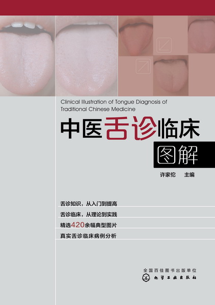 中医舌诊临床图解 许家佗 主编