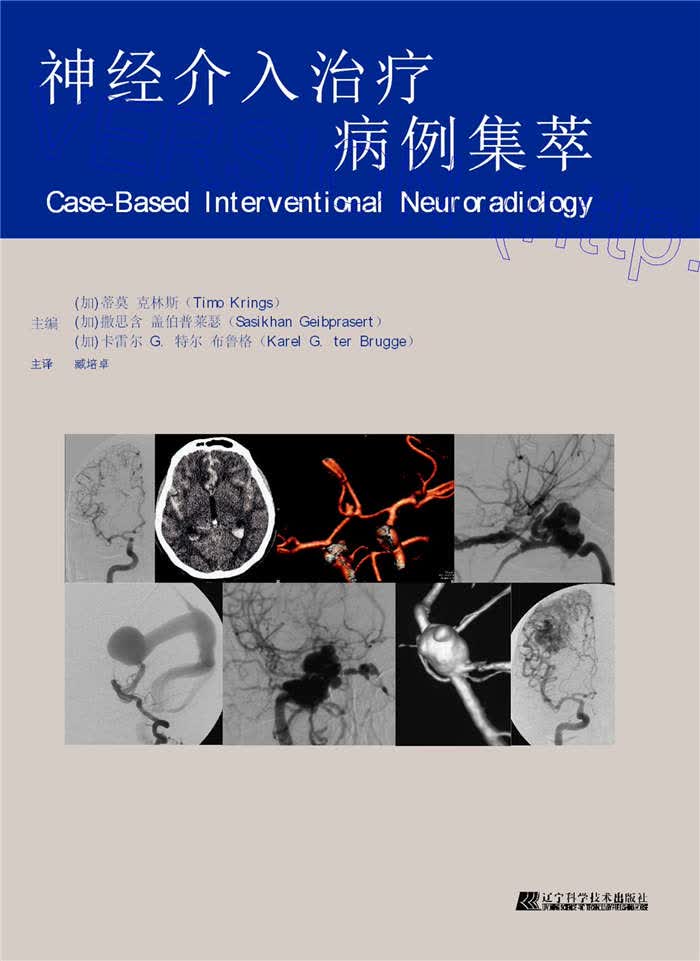 神经介入治疗病例集萃