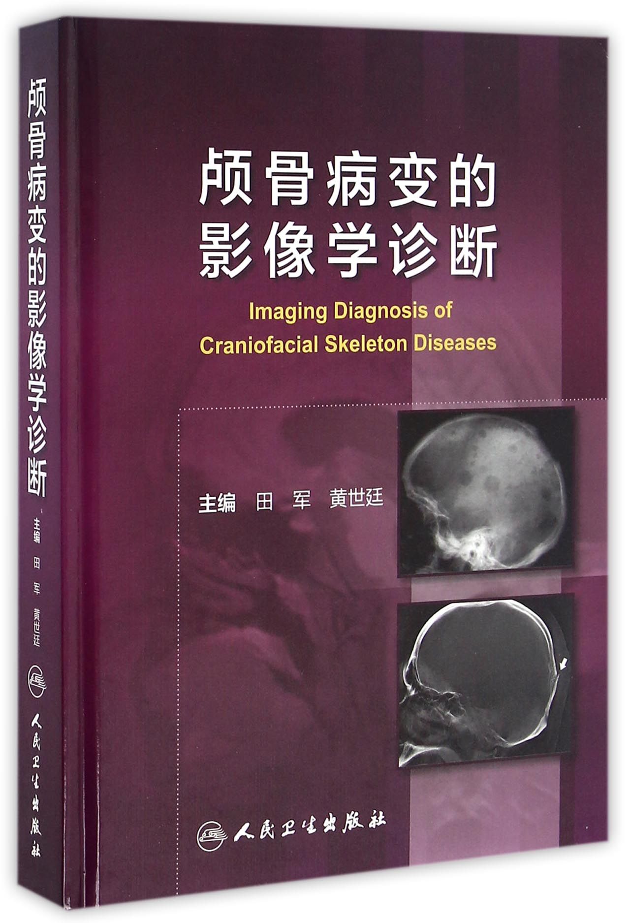 颅骨病变的影像学诊断 9787117228183 人民卫生 主编田军, 黄世廷