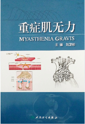 重症肌无力