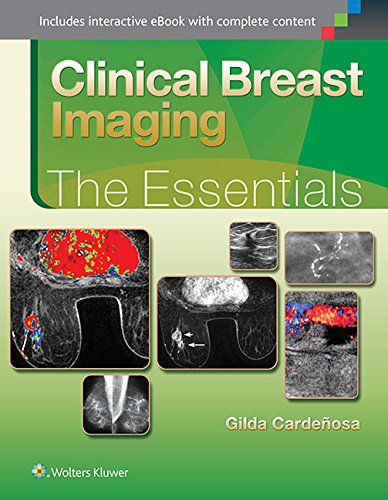 Breast Imaging: The Essentials