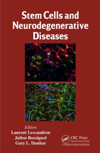 Stem Cells and Neurodegenerativ