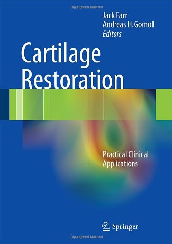 Cartilage Restoration: Pract