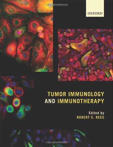Tumor Immunology and