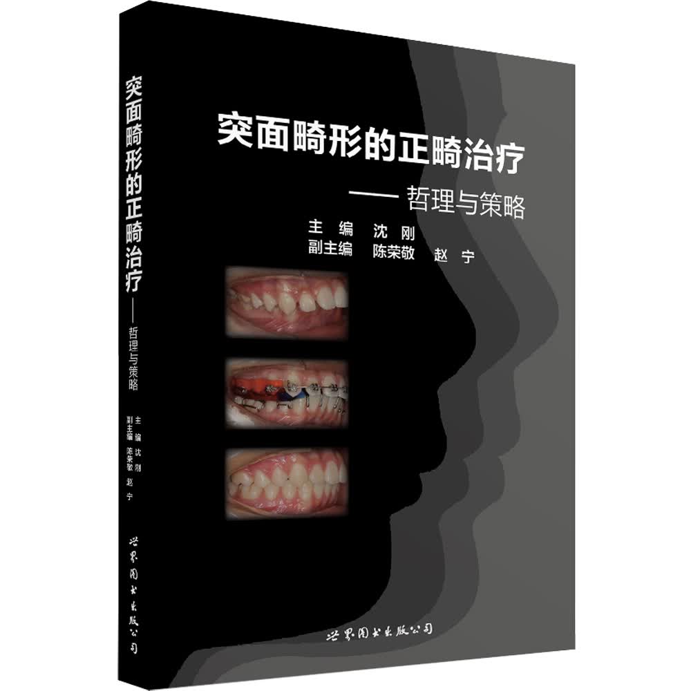 突面畸形的正畸治疗：哲理与策略