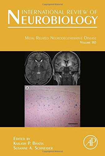 Metal Related Neurodegenerativ