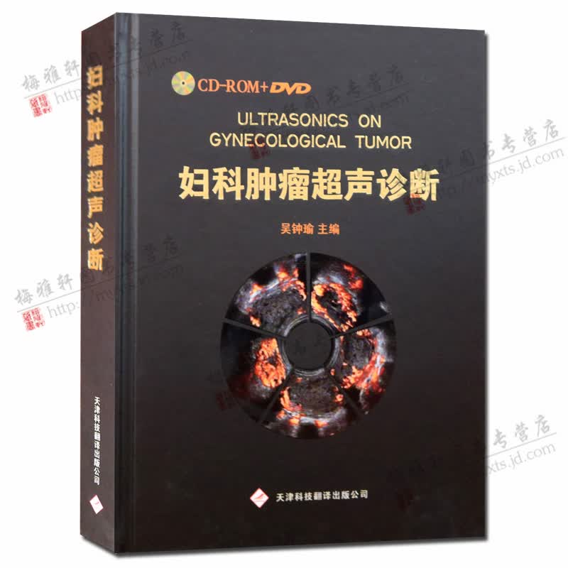 妇科肿瘤超声诊断 附光盘 妇科肿瘤学 妇产科手术学 超声 天津科技翻译出版公司