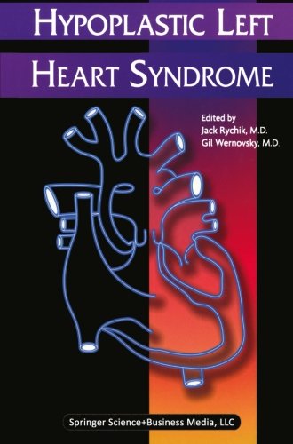 Hypoplastic Left Heart Syndrome