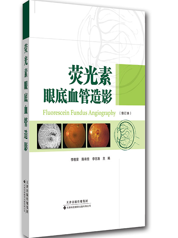 【L】#荧光素眼底血管造影9787543334410