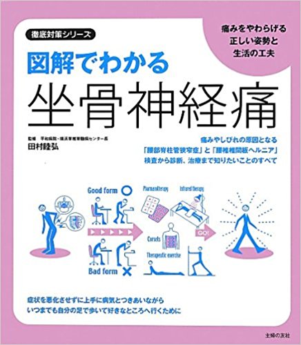 図解でわかる坐骨神経痛