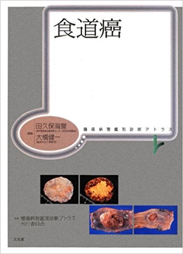 食道癌