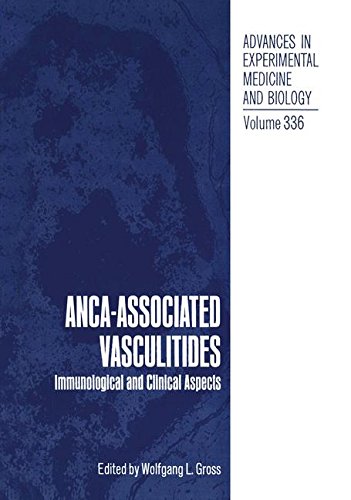 Anca-Associated Vasculitides: