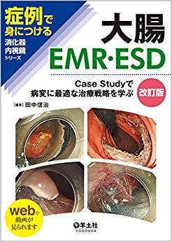 大腸emr?Esd Case Studyで病変に最適な治療戦略を学ぶ