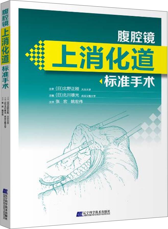 腹腔镜上消化道标准手术