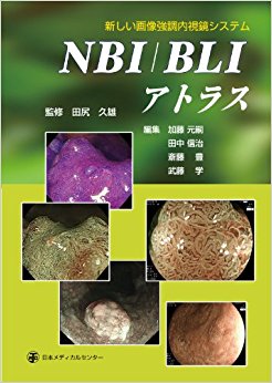Nbi/Bliアトラス 新しい画像強調内視鏡システム