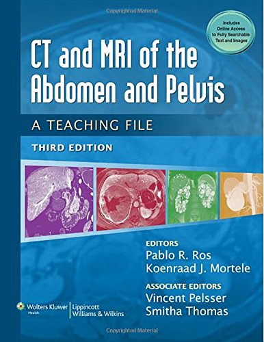 CT & MRI of the Abdomen and Pelvis: A
