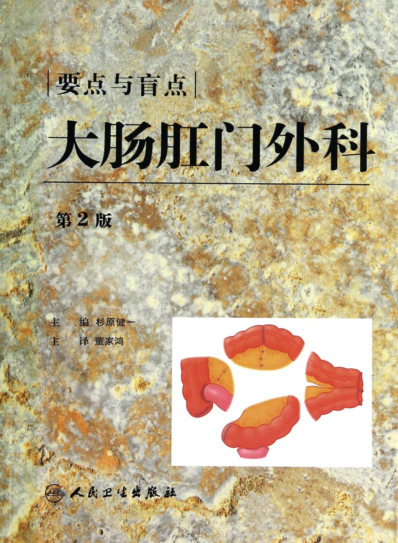 要点与盲点：大肠肛门外科
