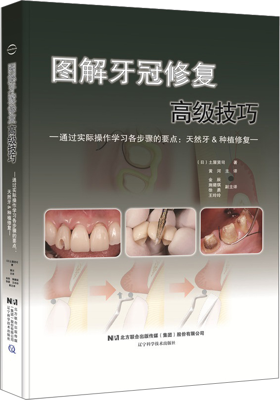图解牙冠修复高级技巧