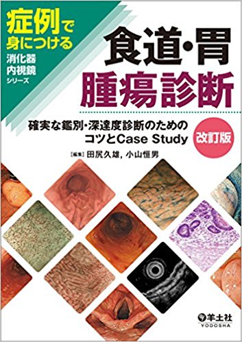 食道?胃腫瘍診断 改訂版 確実な鑑別?深