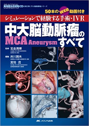 中大脳動脈瘤〈Mca Aneurysm〉のすべて シミュレーションで経験する手術?Ivr 50本