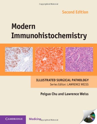 Modern Immunohistochemistry with