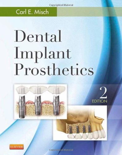 Dental Implant Prosthetics