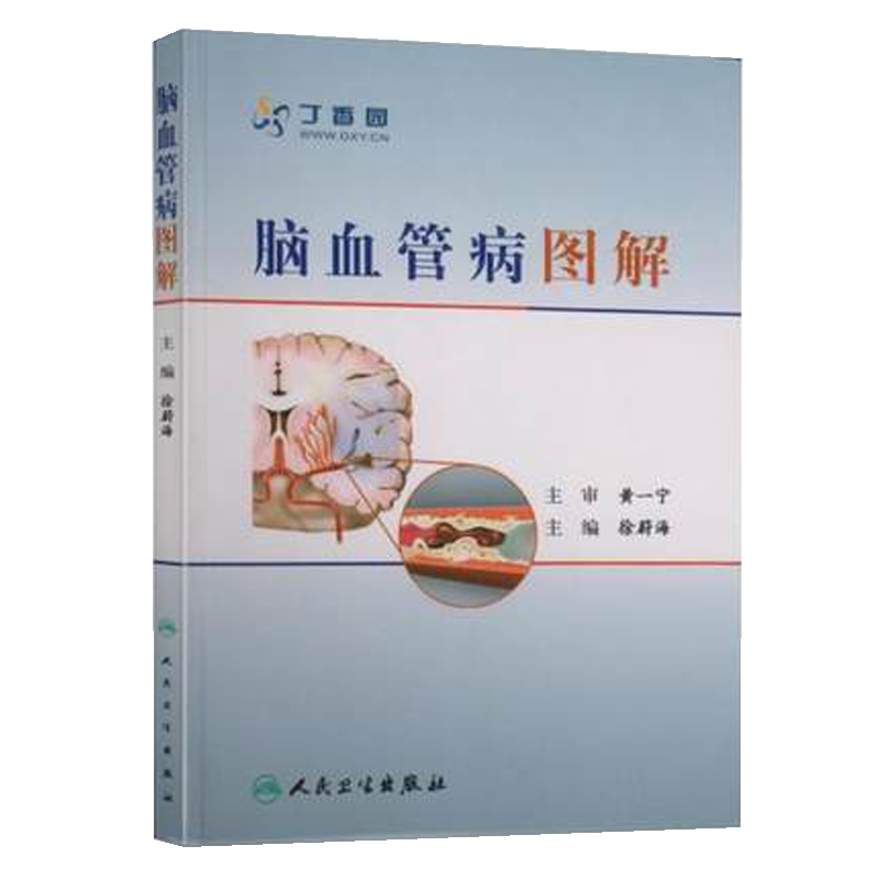 脑血管病图解9787117140041