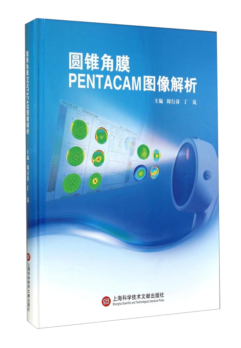 圆锥角膜Pentacam图像解析
