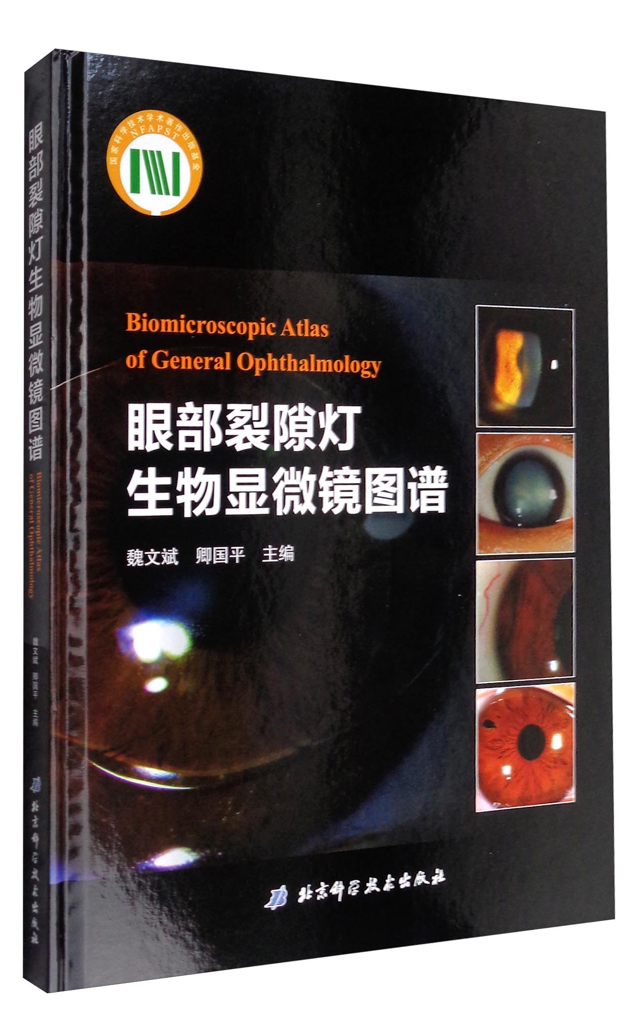眼部裂隙灯生物显微镜图谱《现货速发》，