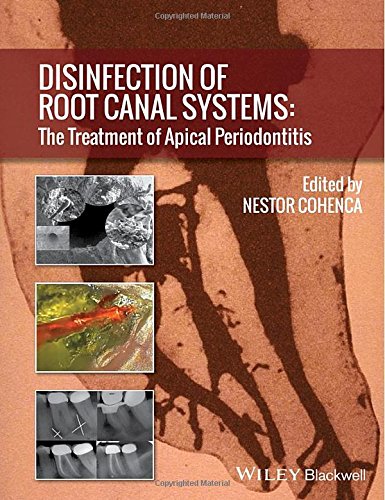 Disinfection of Root Canal Systems: The