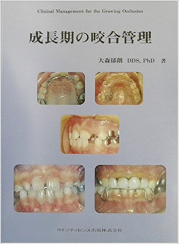成長期の咬合管理