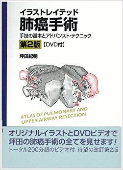 イラストレイテッド肺癌手術 手技の基本とアドバンスト?テクニック