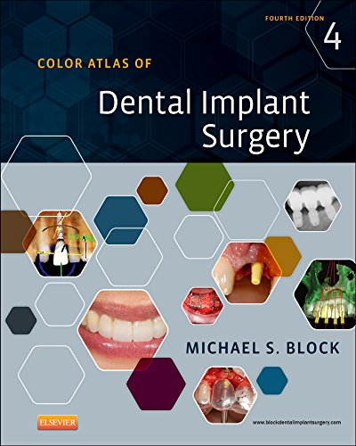 Color Atlas of Dental Implant