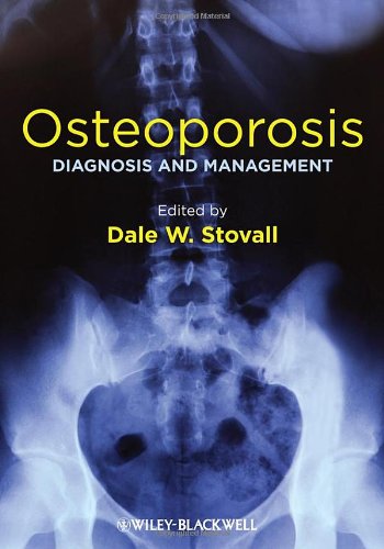 Osteoporosis: Diagnosis and