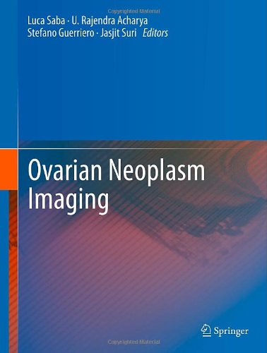Ovarian Neoplasm Imaging