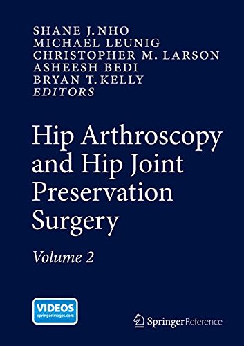 Hip Arthroscopy and Hip Join