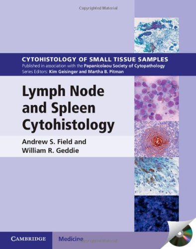 Lymph Node and Spleen