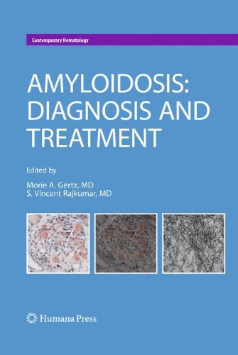 Amyloidosis: Diagnosis and