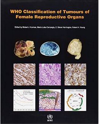 WHO Classification of Tumours of Female
