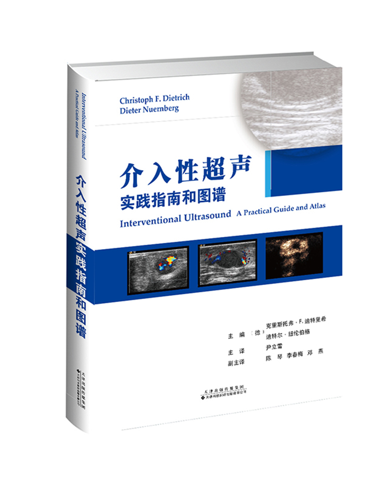 介入性超声实践指南和图谱