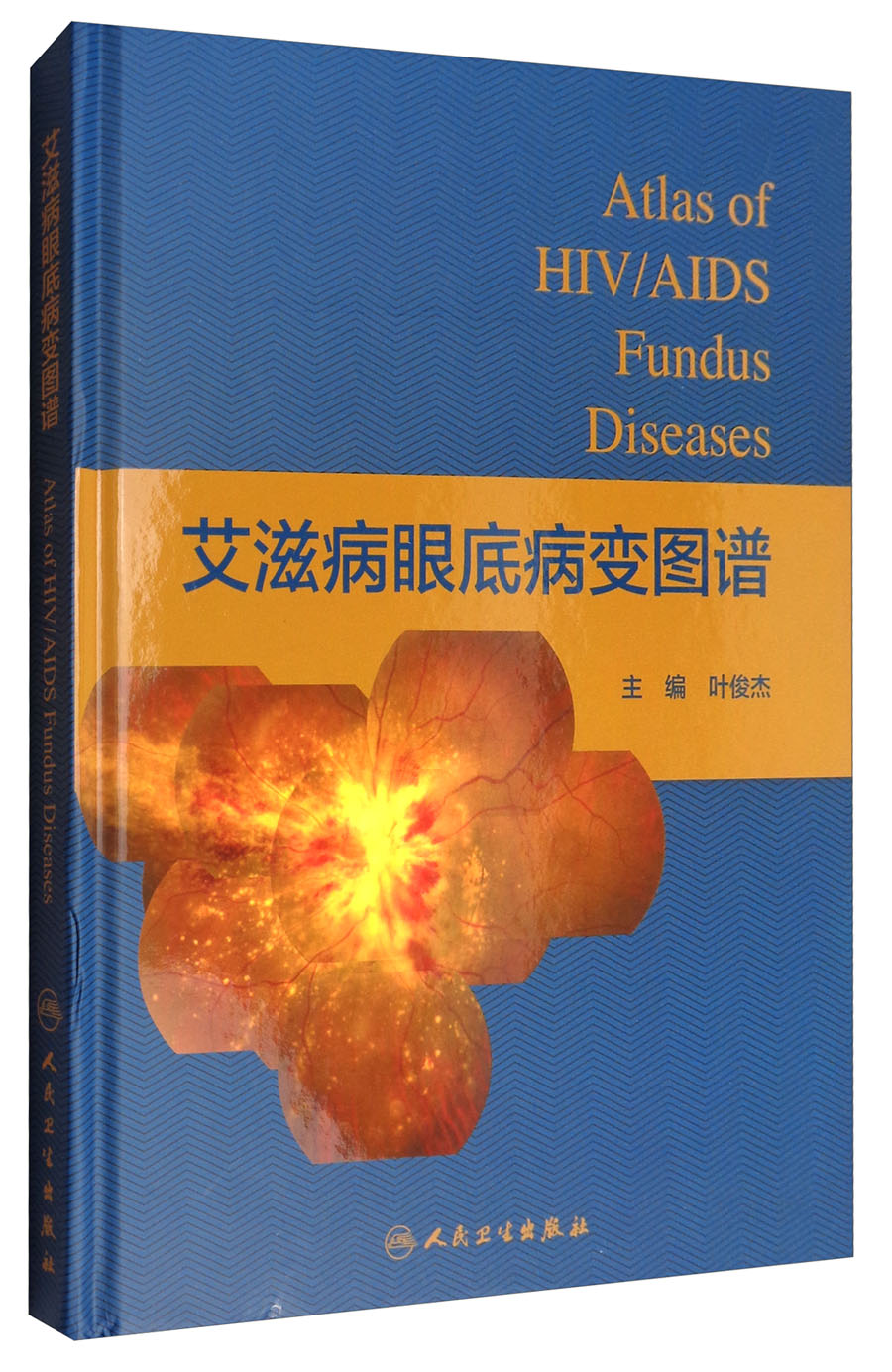 艾滋病眼底病变图谱